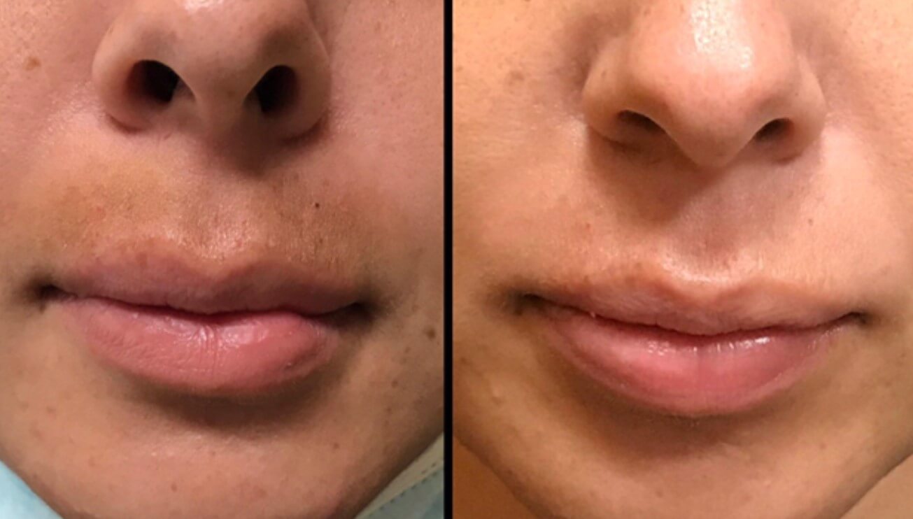 Tri-Luma Unveiled: Does Tri-Luma Need To Be Refrigerated?